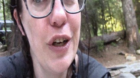 Uvula And Mouth Inspection Outdoors Mp Molly Silver S Mouth Clips Sale Com