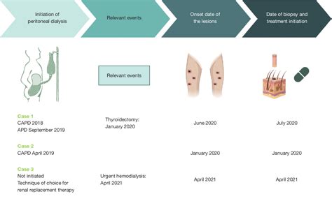 Figure 1 From Acquired Perforating Dermatosis In Patients On Peritoneal