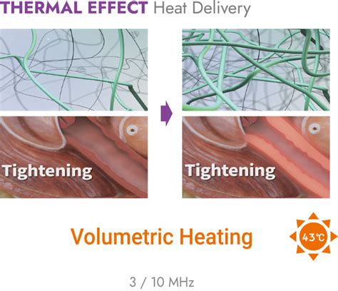 Vaginal Ultrasound Medical Devices For Women Newpong