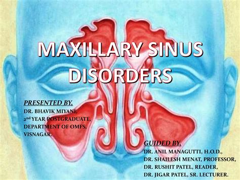 Disorders Of Maxillary Sinus Pptx