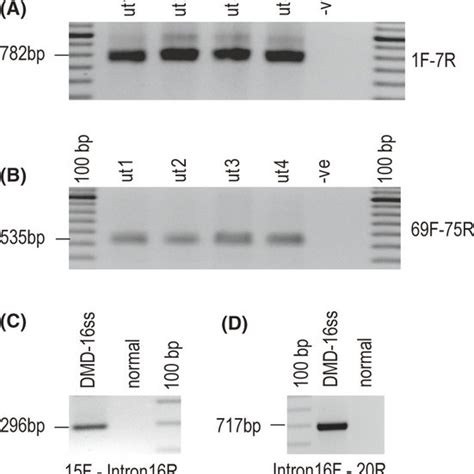Arrangement Of Dystrophin Exons A 1517 And B 4347 Indicating
