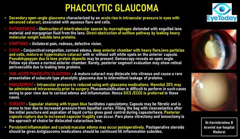 Phacolytic Glaucoma Eyetoday