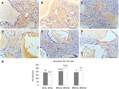 Immunoexpression Of Osteocalcin In Representative Sections Of Ectopic