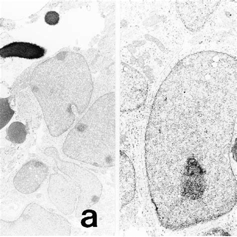 Pyknotic Cells In The Lung A Liver B Craniofacial Tissue C And