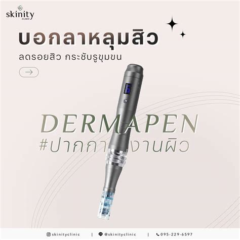 Dermapen Microneedling รักษาหลุมสิว กระชับรูขุมขน