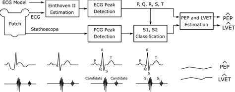 Ecg And Pcg Peak Detection And Classification Of S1 And S2 Candidates Download Scientific