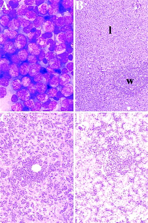 Leukemic Transformation Is Characterized By Dissemination Of Immature Download Scientific