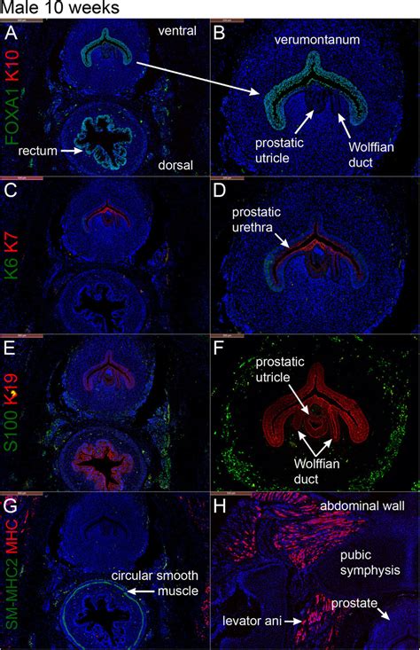 Transverse Sections Through The Verumontanum Male Specimen And Rectum