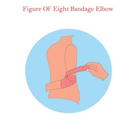 Putting On A Spiral Bandage Is Used In First Aid Figure Of Eight Bandage Elbow Medical Concept