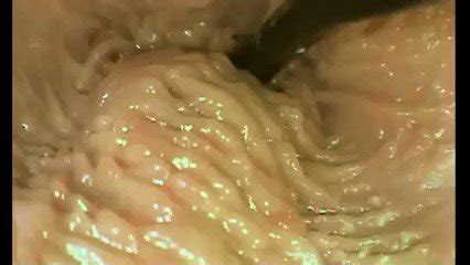 𝓡𝓸𝓼𝓮𝓶𝓪𝓻𝔂 on Twitter RT PostVidss https t co lxfKLnnczD Twitter