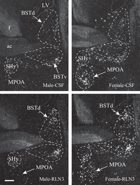Dark Field Micrographs Showing The Positive Hybridization Signal Of Crf Download Scientific