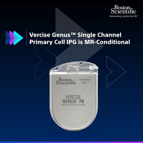 Boston Scientific Deep Brain Stimulation On Linkedin Imageready™ Mr