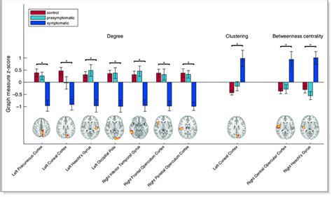 Significant Structural Connectomics Measures Averaged Per Group And Download Scientific Diagram
