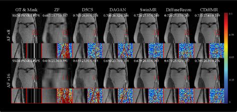 Figure 3 From Cdiffmr Can We Replace The Gaussian Noise With K Space Undersampling For Fast Mri
