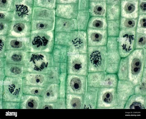 Plant Cell Mitosis Light Micrograph Of Root Tip Cells From An Onion Allium Sp Undergoing
