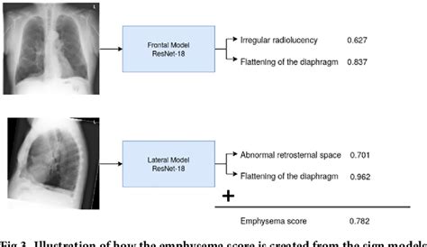Figure 3 From Explainable Emphysema Detection On Chest Radiographs With Deep Learning Semantic