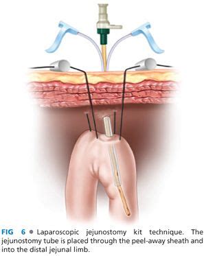 Image00654 Jpeg Abdominal Key