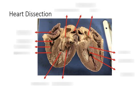 Heart Dissection Diagram Quizlet