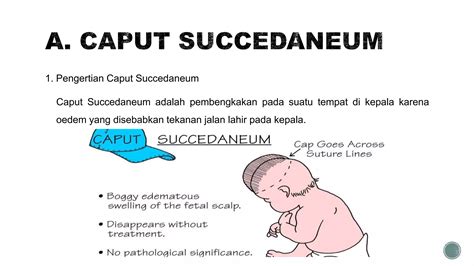 Konsep Dasar Neonatus Dengan Jejas Persalinan Pptx