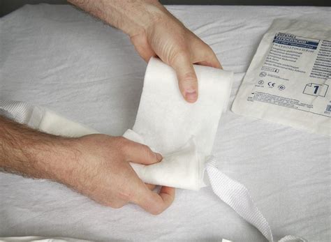 Upper Extremity Splints And Casts Clinical Tree