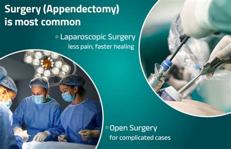 Appendix In Females Causes Symptoms And Treatment