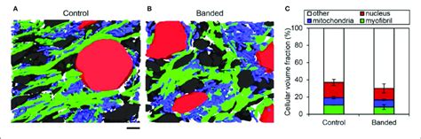 Fib Sem Organelle Volume Quantitation Summary Example 3d Myocardium