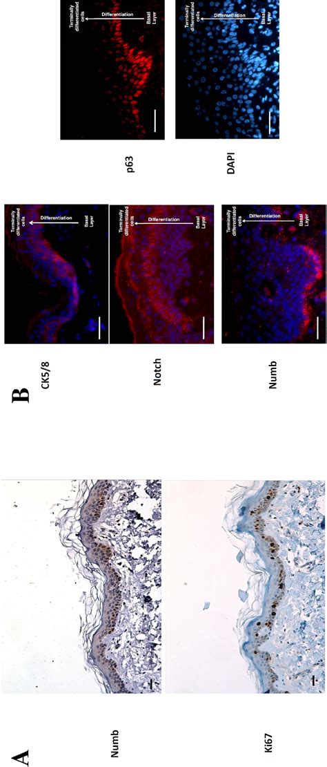 Numb Expression In Normal Epidermis Paraffin Embedded Sections From