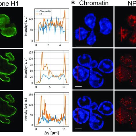 Distribution Of Chromatin And Nuclear Features In Expanded And Download Scientific Diagram