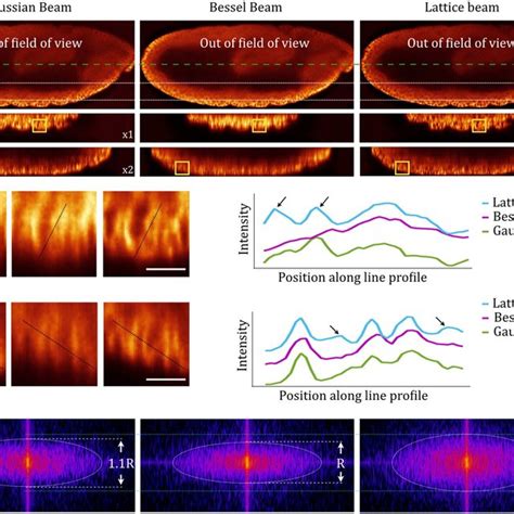 Pdf Sspim A Beam Shaping Toolbox For Structured Selective Plane Illumination Microscopy