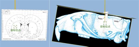 无需调平，精准定位！全自动脑立体定位仪新升级~ 知乎