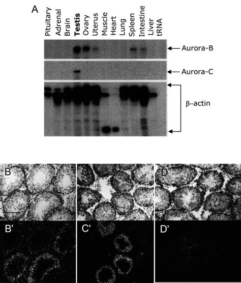 Expression Analysis Of Mouse Aurora B And C A Comparison Of Download Scientific Diagram