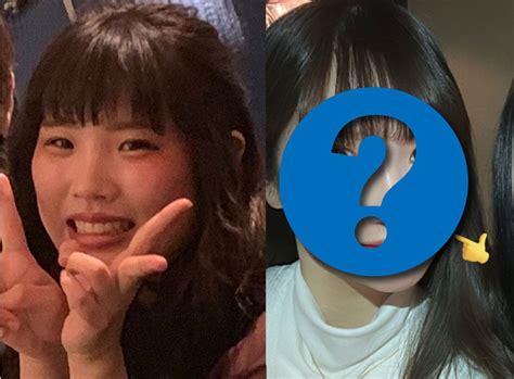 画像・写真 元彼に“ブス”と振られた女性が1800万の整形でたどり着いた生き方「自分を変えられるのは自分だけ」 ｜最新ニュース 2枚目