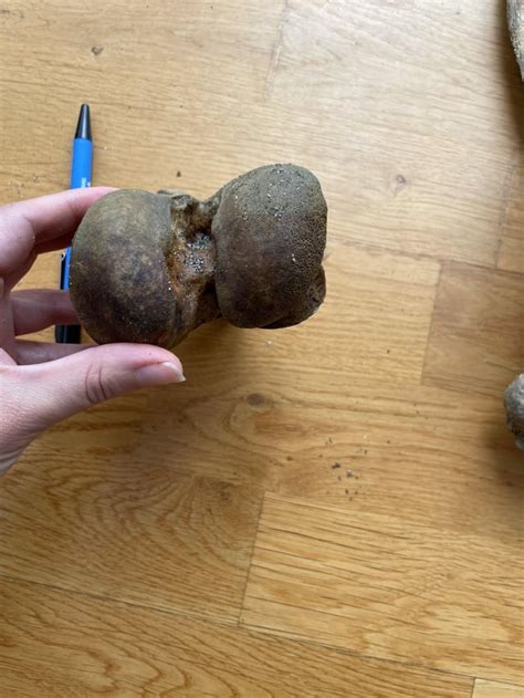 Whose Scapula Radius And Partial Femur Do I Have R Boneid