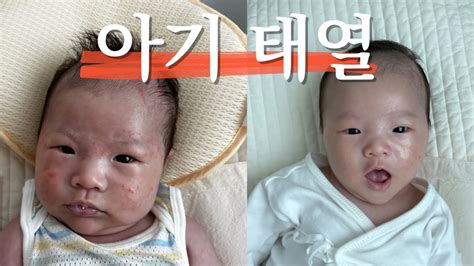 👶🏻 육아 Vlog 신생아 아기 태열 로션 제품 추천 수면 환경 쿨리베어 옆잠베개 머미쿨쿨 수딩젤 란시노크림