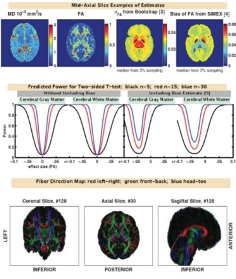 DTI Quality Control Part Further Reading Diffusion Imaging Introduction Tutorials And
