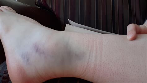 My Strength Was Put To The Test And My Bones Have Come Out Victorious And Whole R