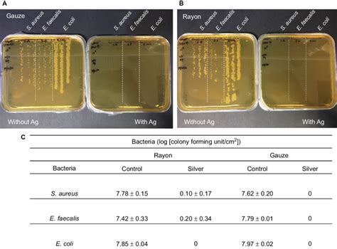 The Drop Culture Of Three Different Strains Of Bacteria Staphylococcus Download Scientific
