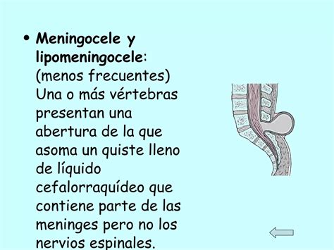 Espina Bifida 1 Ppt