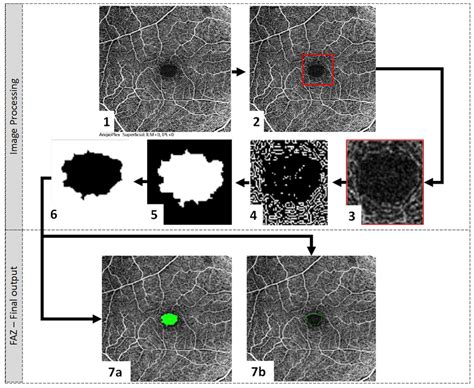 Methodology Flow Chart Image Processing Original Non Marked Download Scientific Diagram