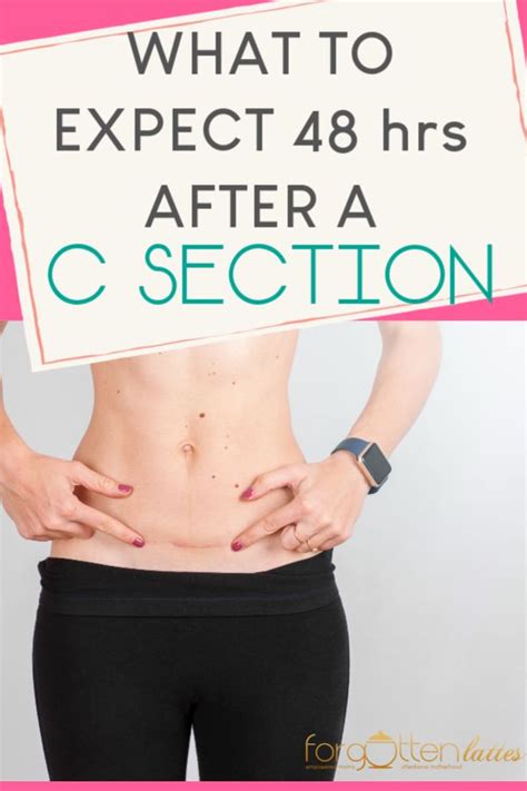 C Section Recovery What Will The First 48 Hours Look Like Forgotten