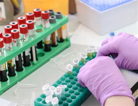 9 те кръвни показателя които казват всичко за вашето здраве