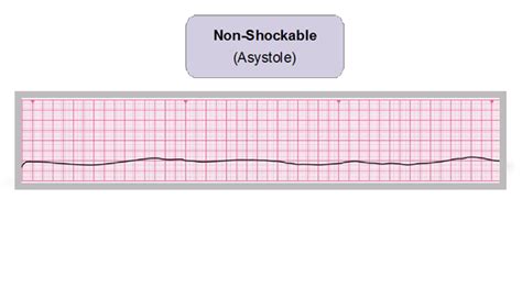 Resuscitation Council UK Advanced Life Support Using The ALS Treatment Algorithm