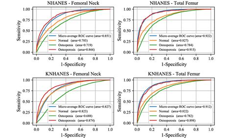 Performance Of Deep Learning Dl Models On The Nhanes And Knhanes Data