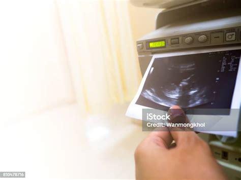 초음파 시스템 프린터를 통해 인쇄 하는 아기의 초음파 사진 인쇄공에 대한 스톡 사진 및 기타 이미지 인쇄공 병원 의사