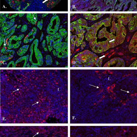 Antibodies And Multiplex Immunofluorescence Groupings Download Table