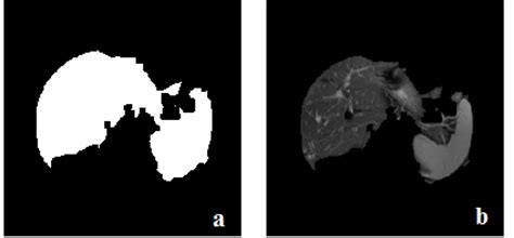 A Reconstructed Liver Image B Grayscale Segmented Image Download Scientific Diagram