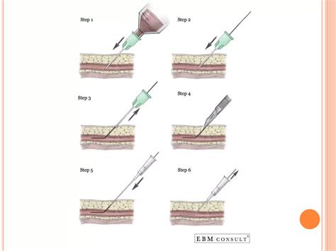 Monitoring In Anaesthesia Ro PPTX