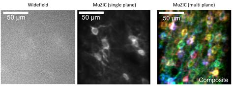 High Contrast Voltage Imaging Biomicroscopy Lab
