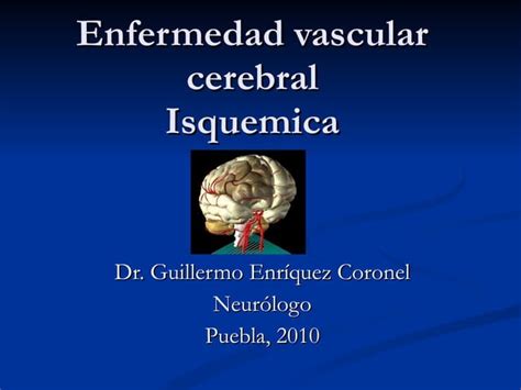 Enfermedad Vascular Cerebral Ppt
