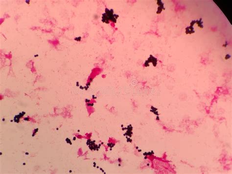 Gram Positive Cocci Biological Sample Gram Color Stock Image Image